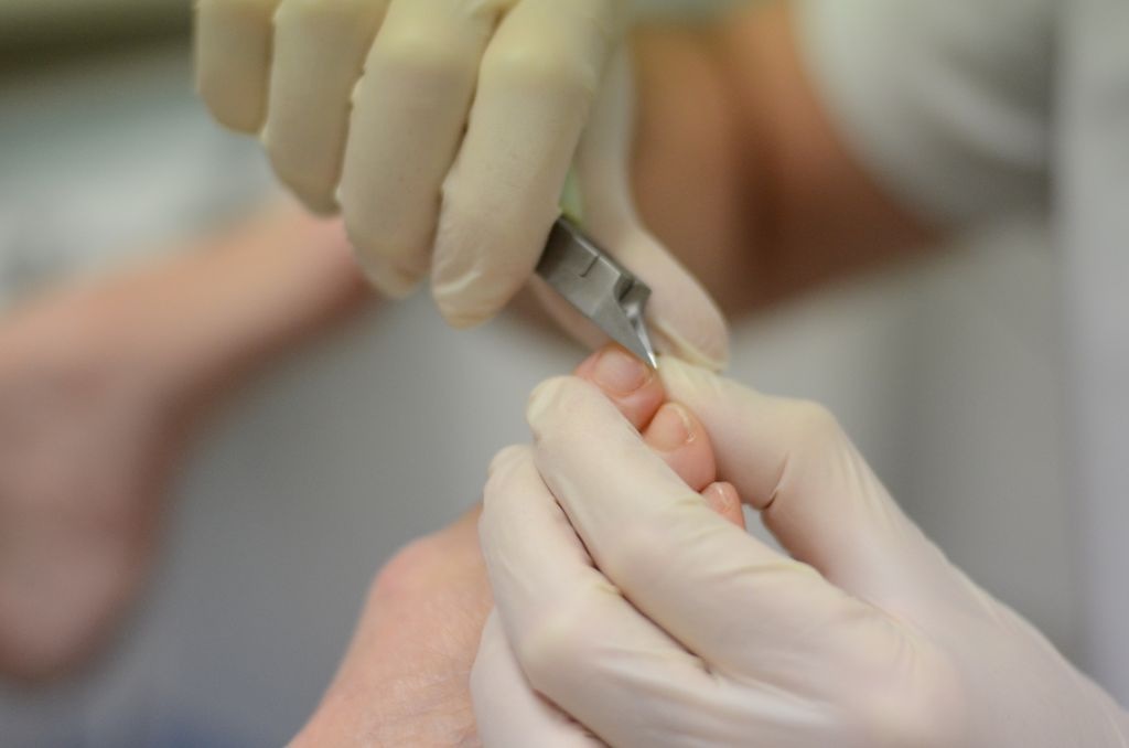 Quel est le rôle du Pédicure Podologue ? Podologue Lille, Somain, 59