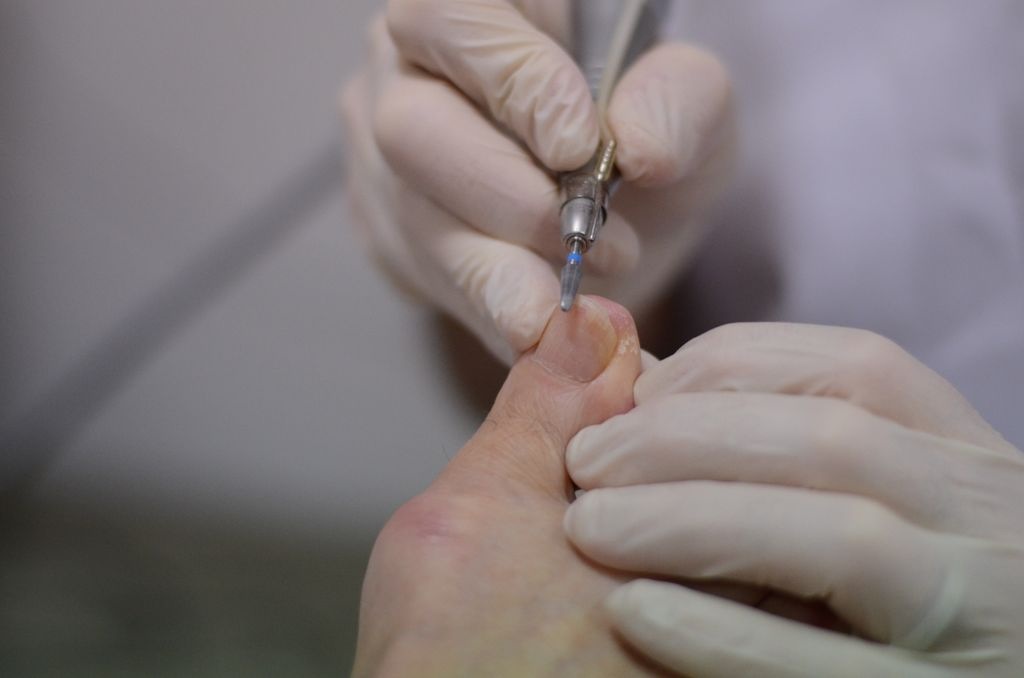 Quel est le rôle du Pédicure Podologue ? Podologue Lille, Somain, 59